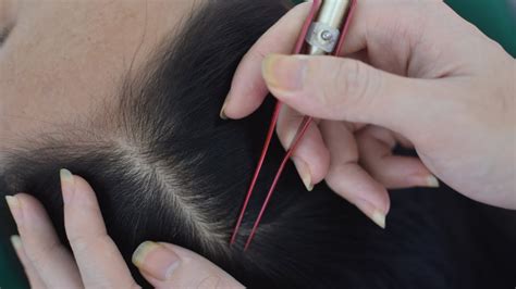 ASMR Scalp Scratching Aggressive, Scalp Check Real Person For Relieve Stress - YouTube