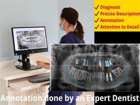 Interpretation And Annotation For Dental Radiographs Panoramic Bitewing