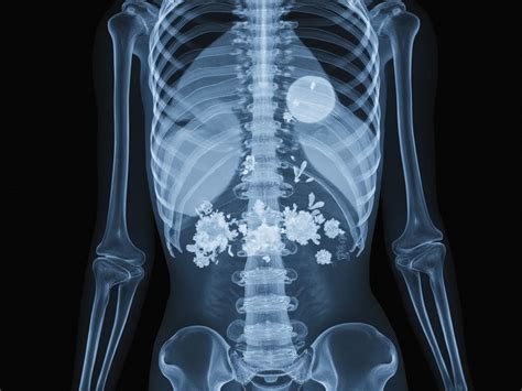 Researchers Warn Of Bias In Ai Driven Cancer Detection Tools