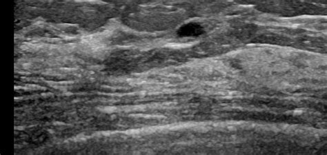 Us Detection Object Detection Dataset And Pre Trained Model By Yolov5rsnabsd1k