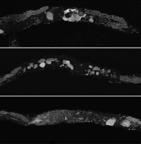 Cep 1p53 Dependent Dysplastic Pathology Of The Aging C Elegans Gonad