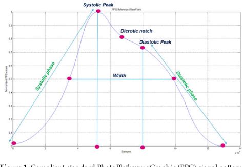 Figure 1 From Deep Lstm With Dynamic Time Warping Processing Framework A Novel Advanced