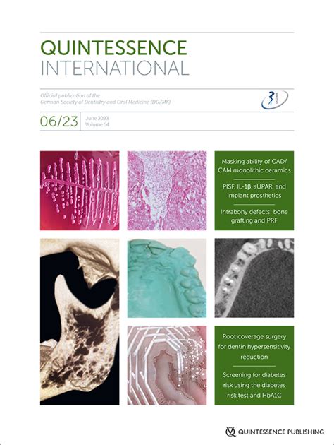 Osteomyelitis Of The Mandible In Patients With A History Of Covid 19