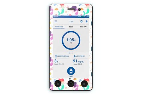 Shop Mermaid Sticker Omnipod Dash Pdm Today Protect Your Cgm