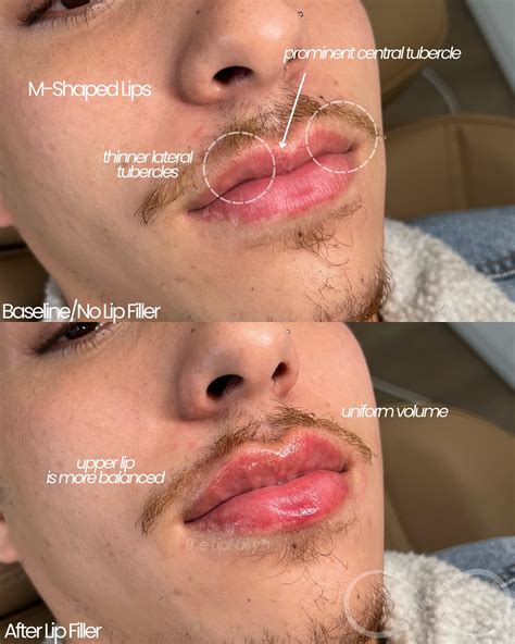 Cassandra Reyes Np • The Lipfairy®️ Lips Chin The Ultimate Power