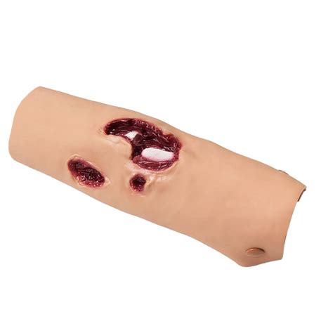 Simulaids® Simulated Compound Fracture Tibia Simulaids