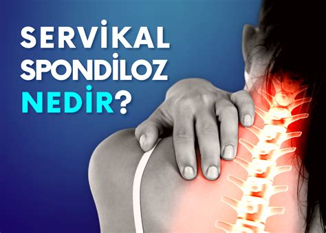Servikal Spondiloz Turanandturan