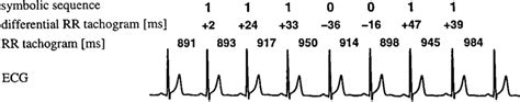 Example Of Construction Of Symbolic Sequences From Electrocardiogram