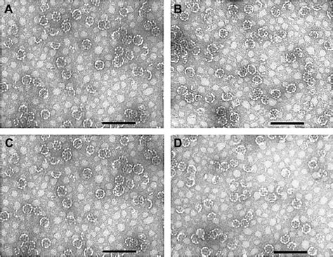 Transmission Electron Microscope Images Notes Iscom Matrix A Download Scientific Diagram