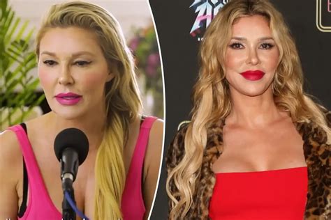 Brandi Glanville And Plastic Surgery A Story Of Struggles And Recovery