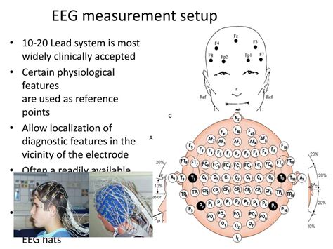 PPT What Is EEG PowerPoint Presentation Free Download ID 5505871