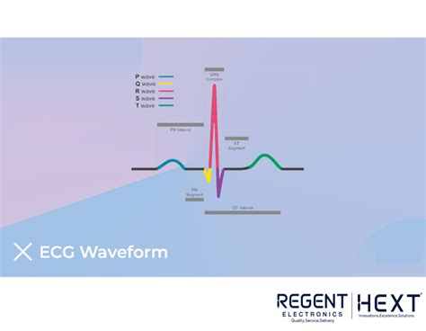 Ad8232 Heart Rate Monitor A Detailed Guide With Arduino Interfacing