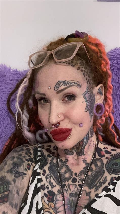 Scoliosis Kyphosis Heds Sci~ For Uncropped Version And More Check Comments