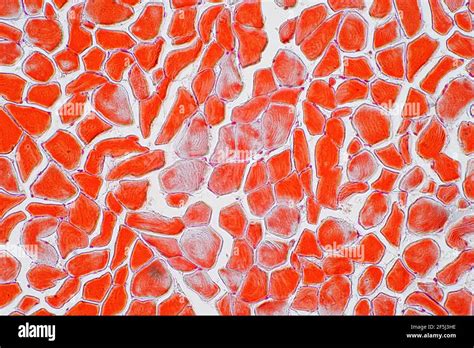 Skeletal Muscle Fibres Light Micrograph Hi Res Stock Photography And Images Alamy