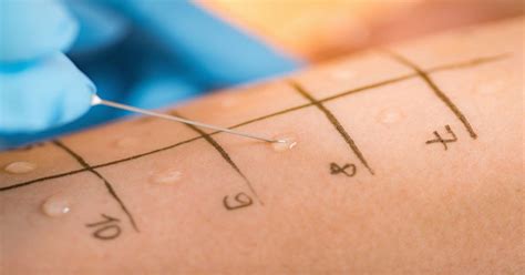 Testing Clears Nearly All Antibiotic Allergy Labels In Pediatric Clinic