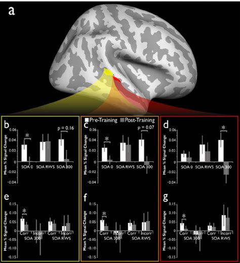 Bold Activity In Posterior Superior Temporal Sulcus Psts Decreases Download Scientific