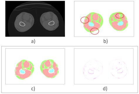 3 Multi Class Segmentation Of A Ct Scan Slice Showing The Legs Of A Download Scientific