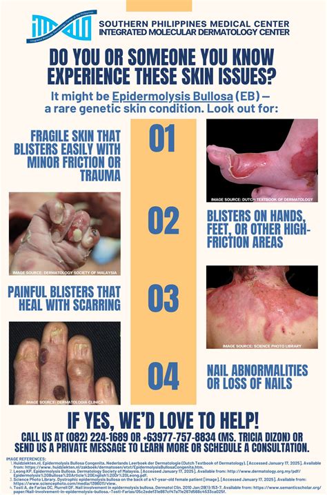 Integrated Epidermolysis Bullosa Eb A Rare But Manageable Skin
