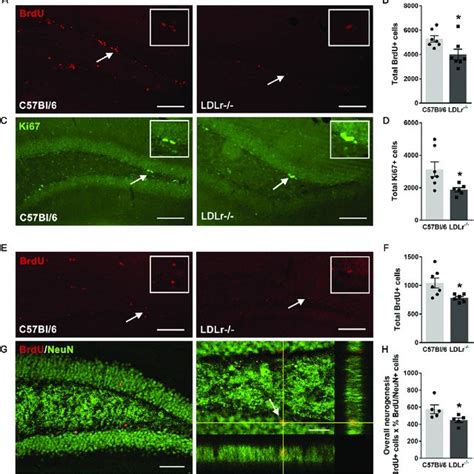 Cell Proliferation And Differentiation In The Granular Cell Layer Of Download Scientific