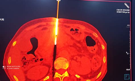 La Microbiopsie Du مركز التصوير الطبي الدكتور براهيمي