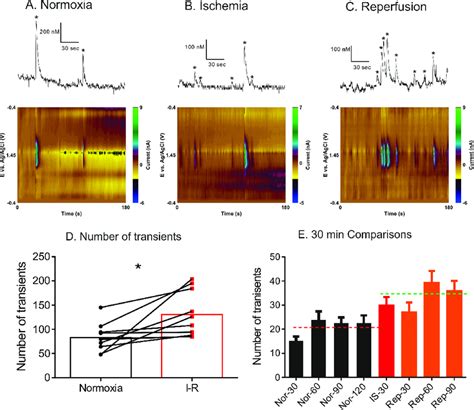 Effect Of Stroke On The Number Of Adenosine Transients In The