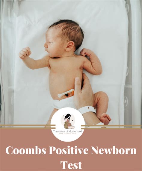 What Does A Coombs Positive Newborn Test Mean Tom