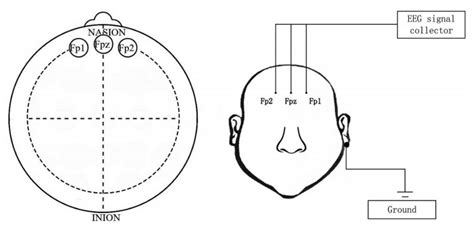 Few Electrode Eeg From The Wearable Devices Using Domain Adaptation For Depression Detection