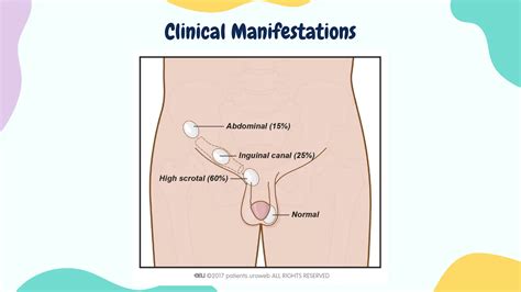Undescended Testes Hydrocele Testicular Torsion Pdf