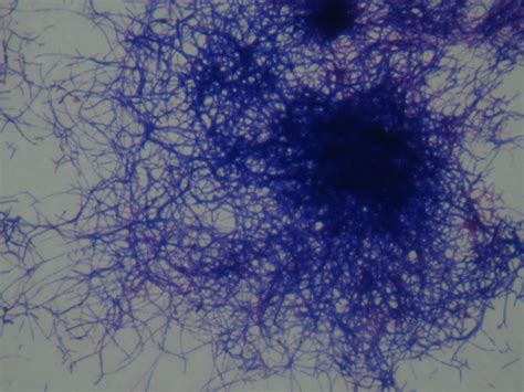 Actinomyces Doccheck