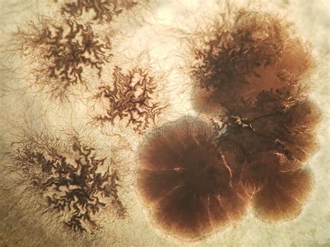 The Art Of Bacteria Microscope View Of Bacillus And Other Bacteria