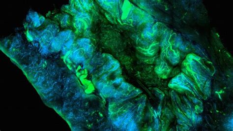 Novel 3d Bioprinting Ink Enhances Tumor Modeling Technology Networks