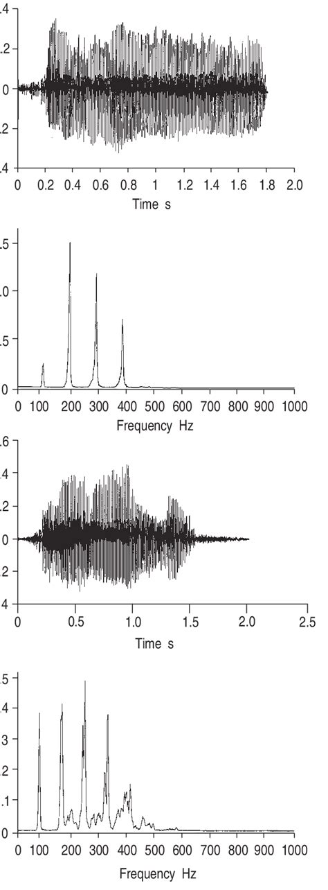 Analysis Of Snoring Signal From A Simple Snorer A Signal Arbitrary Download Scientific