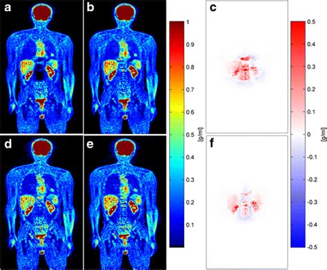 Quantitative images derived from the ¹⁸F FDG PET dataset obtained from Download Scientific