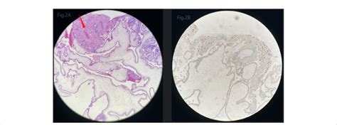 A Microscopic Image Of The Evacuated Mole Tissues Arrow Points To