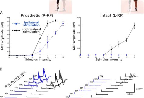 A Relations Between The Intensity Of Transcranial Magnetic Stimulation