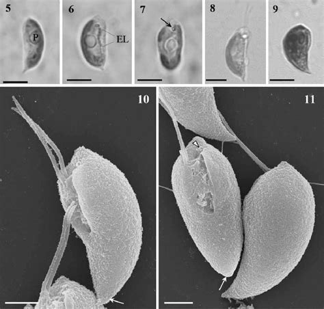 light figs 5 9 and scanning electron figs 10 11 micrographs of