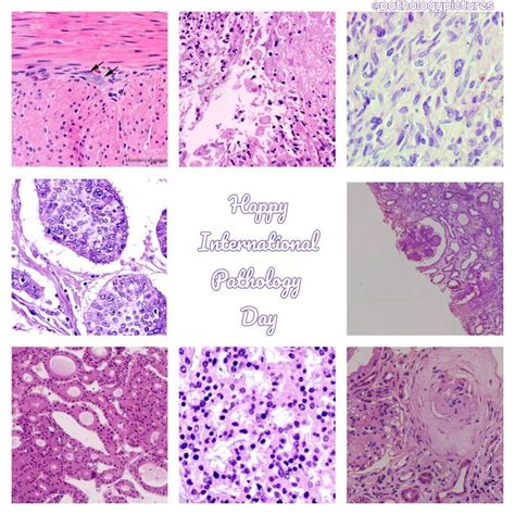 dr sivaranjani selvaraj on linkedin happyinternationalpathologyday