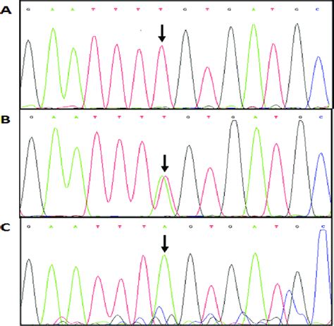 Sequencing Result For Fto Rs9939609 Polymorphism A Tt Genotype B