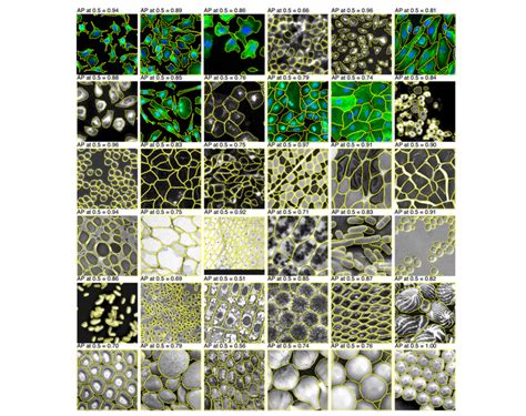 细胞分割神器——cellpose（批量处理篇） 知乎