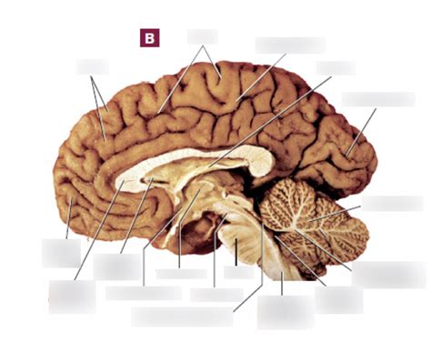 Cadaver Brain Diagram Quizlet