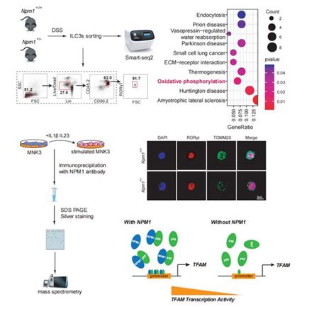 Researchers Reveal Key Role Of Npm1 In Progression Of Inflammatory Bowel Diseases Colorectal
