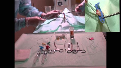 Uvc Insertion Video Youtube