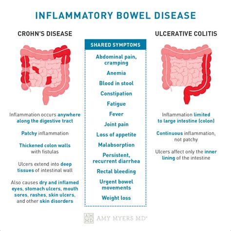 The Myers Way® Approach To Inflammatory Bowel Disease Ammd