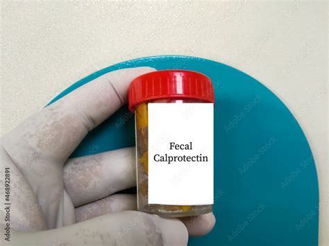 Doctor Holding Stool Specimen Jar For Faecal Calprotectin Test To