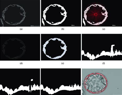 A Canny Edge Detector Applied On The Output Of Level Set B Canny Download Scientific