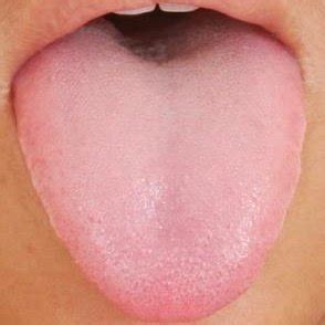 Healthy Tongue Color