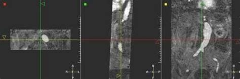 Three Orthogonal Slices Of The Aorta Mr Dataset Download Scientific Diagram