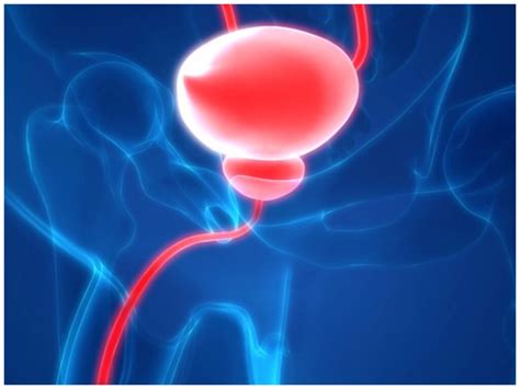 Prostate Laser Surgery Laser Prostatectomy All Your Questions