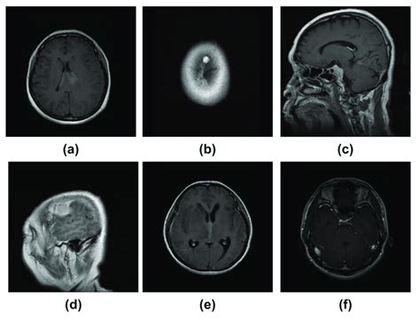 Sample Dataset Images A Texture Similarity B Noisy Sample C Download Scientific