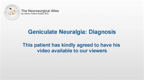 Geniculate Neuralgia Diagnosis Operative Video Cases The
